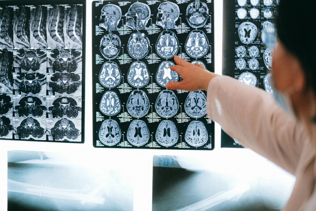 Neurological & Movement Disorder Clinical Trials - Trialmed UK